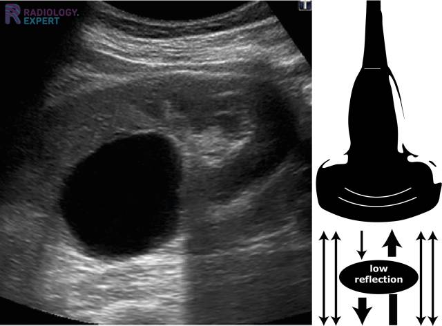 Ultrasound Technique