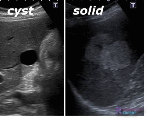 Ultrasound Technique