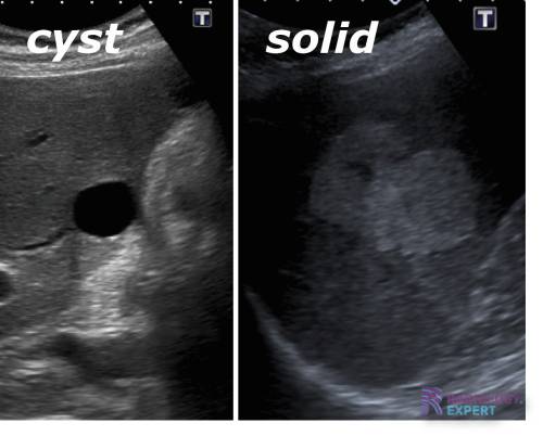 Ultrasound Technique