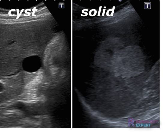 Ultrasound Technique