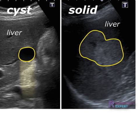 Ultrasound Technique