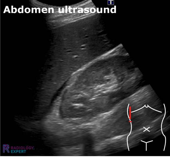 Ultrasound Technique