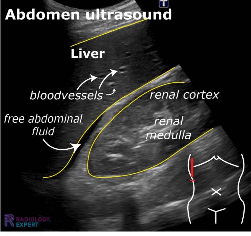 Ultrasound Technique