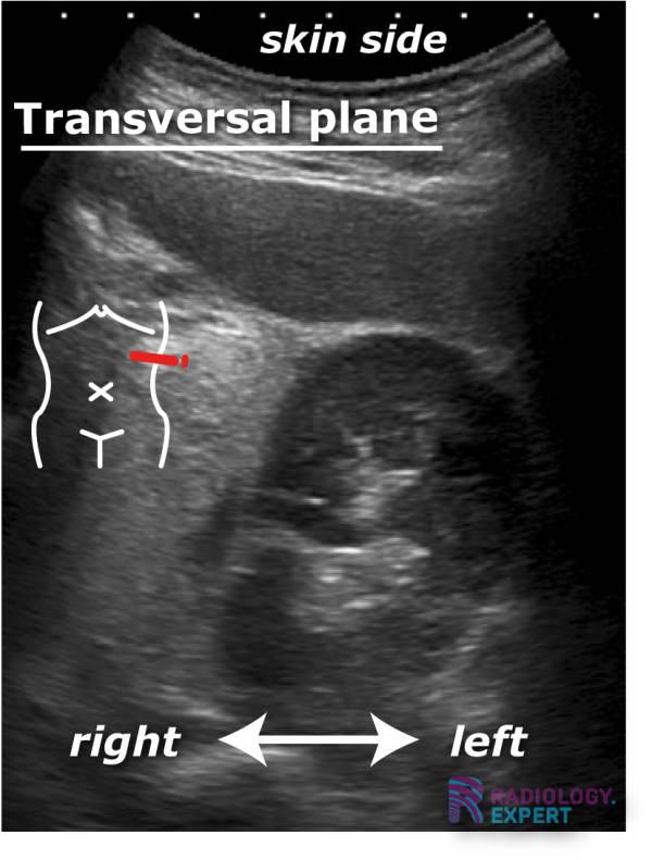 Ultrasound Technique