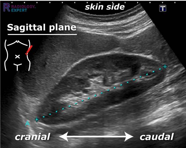 Ultrasound Technique