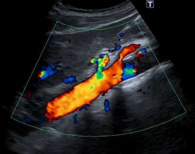 Ultrasound Technique