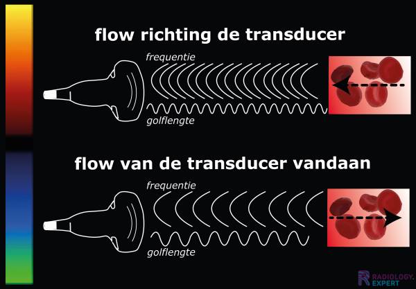 Echografie Techniek