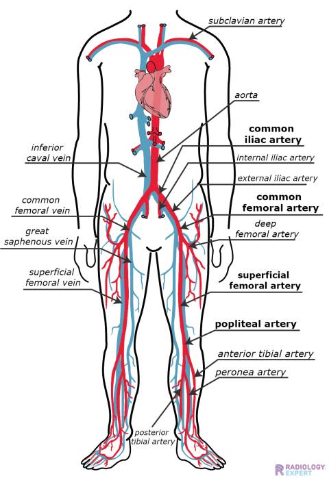Vascular Intervention
