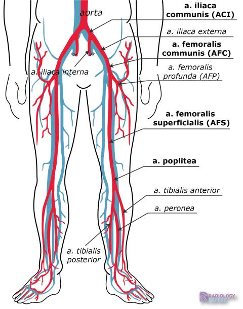 Vasculaire Interventie