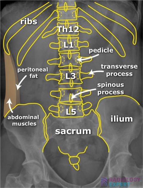 Abdominal X-ray