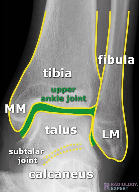 X Ray Ankle Ap