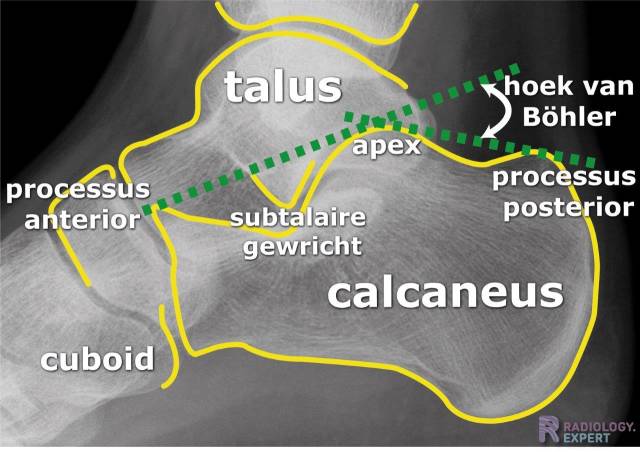 Enkel Kentaurtegning