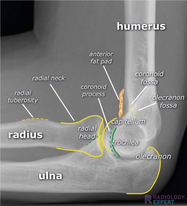 X Elbow