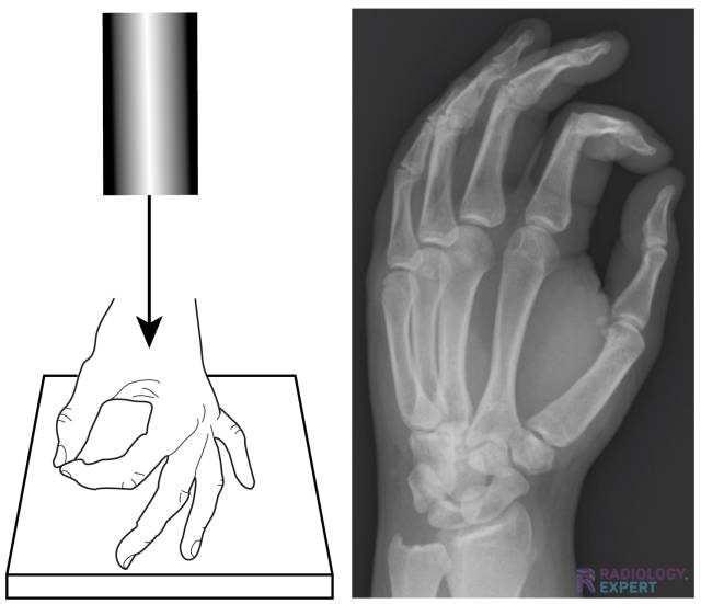 Oblique Angle Radiographs