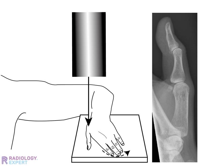 X-Hand