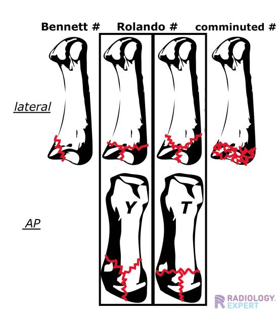 X-Hand