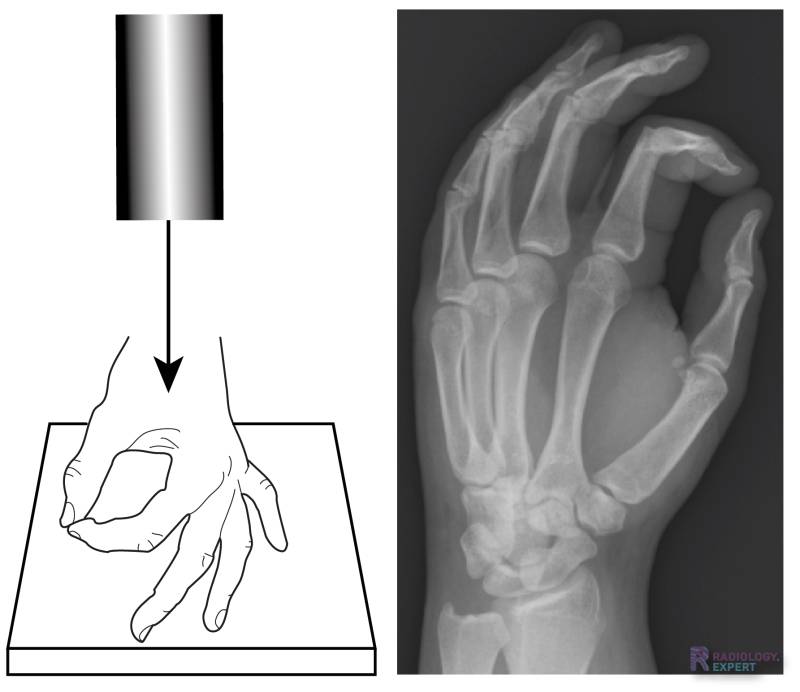 X-Hand
