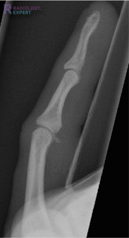 X-Hand