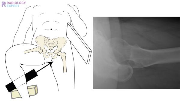 lateral hip positioning