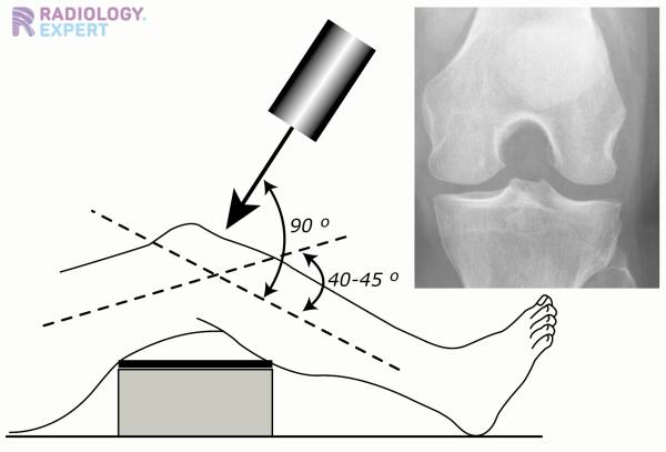 Radiographic Positioning Of The Knee