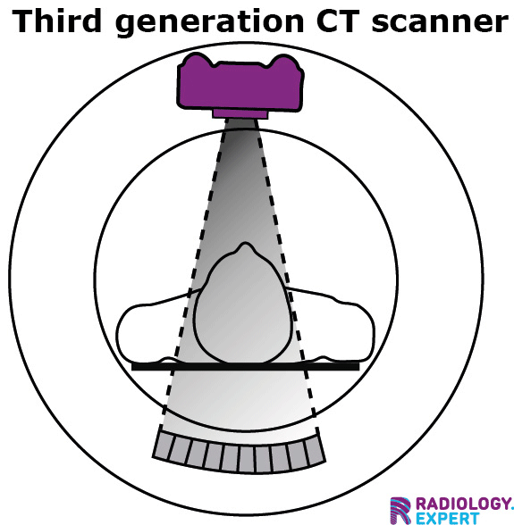 X-ray/CT Technique