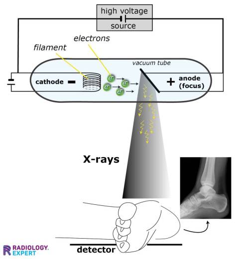 X-ray/CT Technique