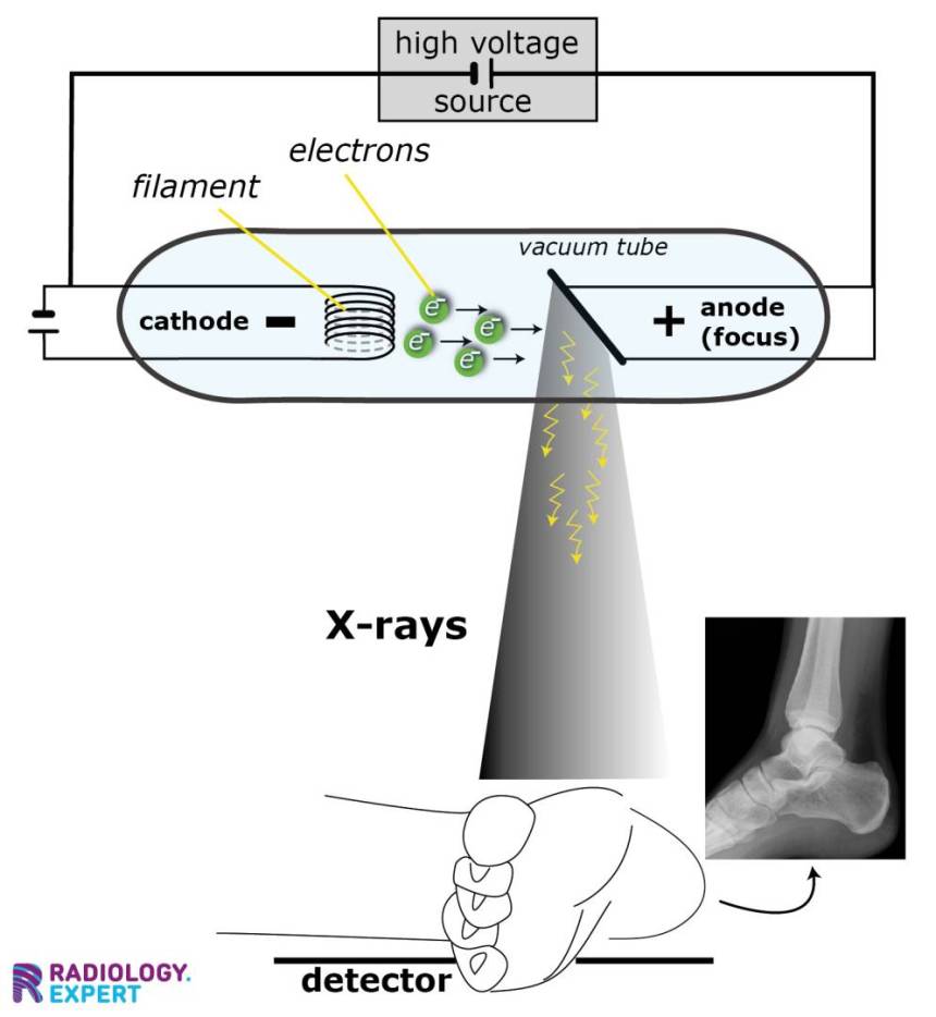 X-ray/CT Technique