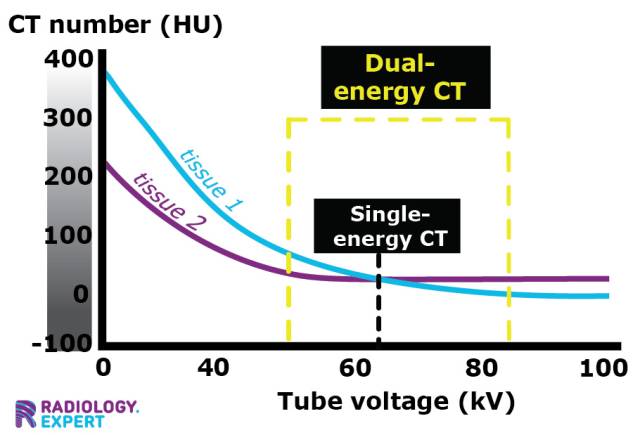 X-ray/CT Technique