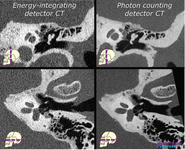 X-ray/CT Technique