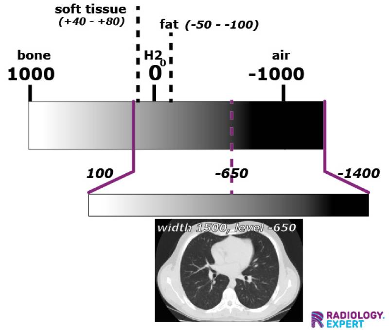 X-ray/CT Technique