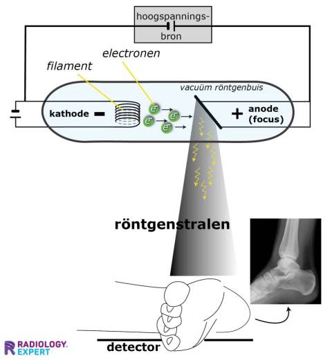 Rontgen/CT Techniek