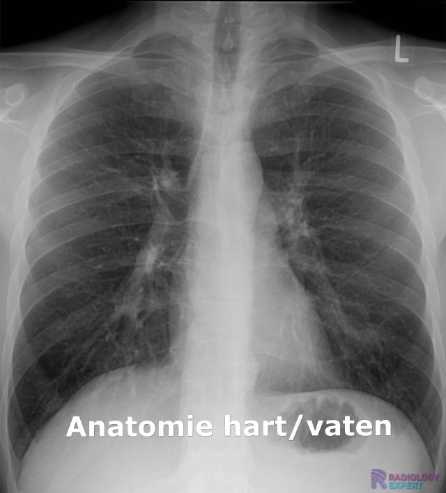 X-Thorax IC