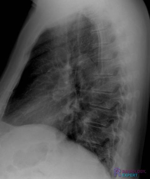 X-Thorax
