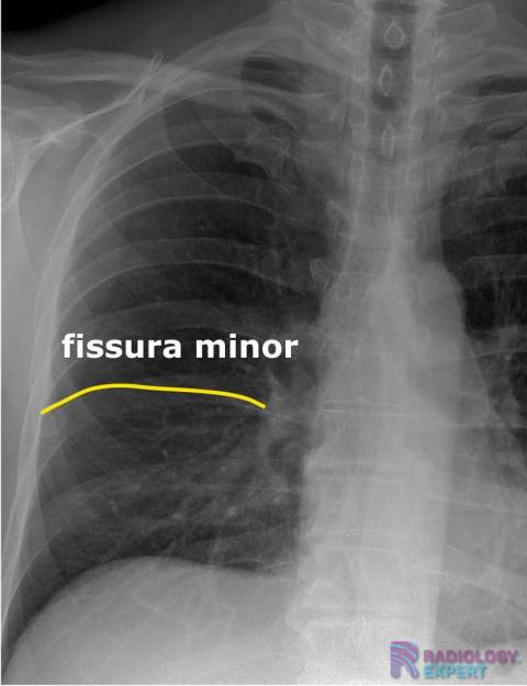 X-Thorax