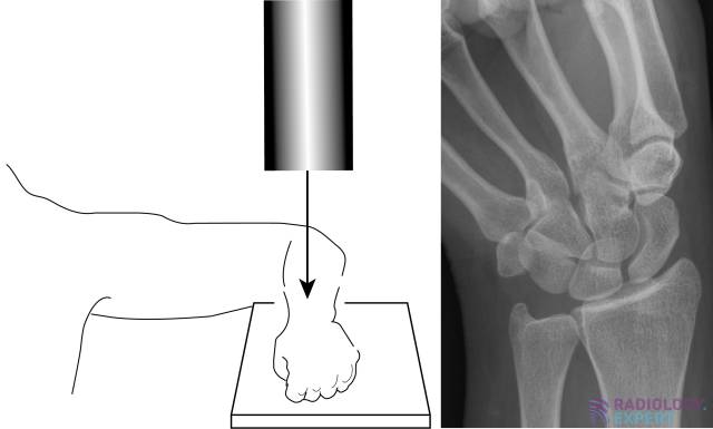 X-Wrist
